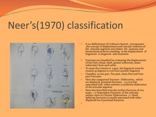 Proximal humerus fracture Management | PPTX