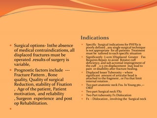 Proximal humerus fracture Management | PPT