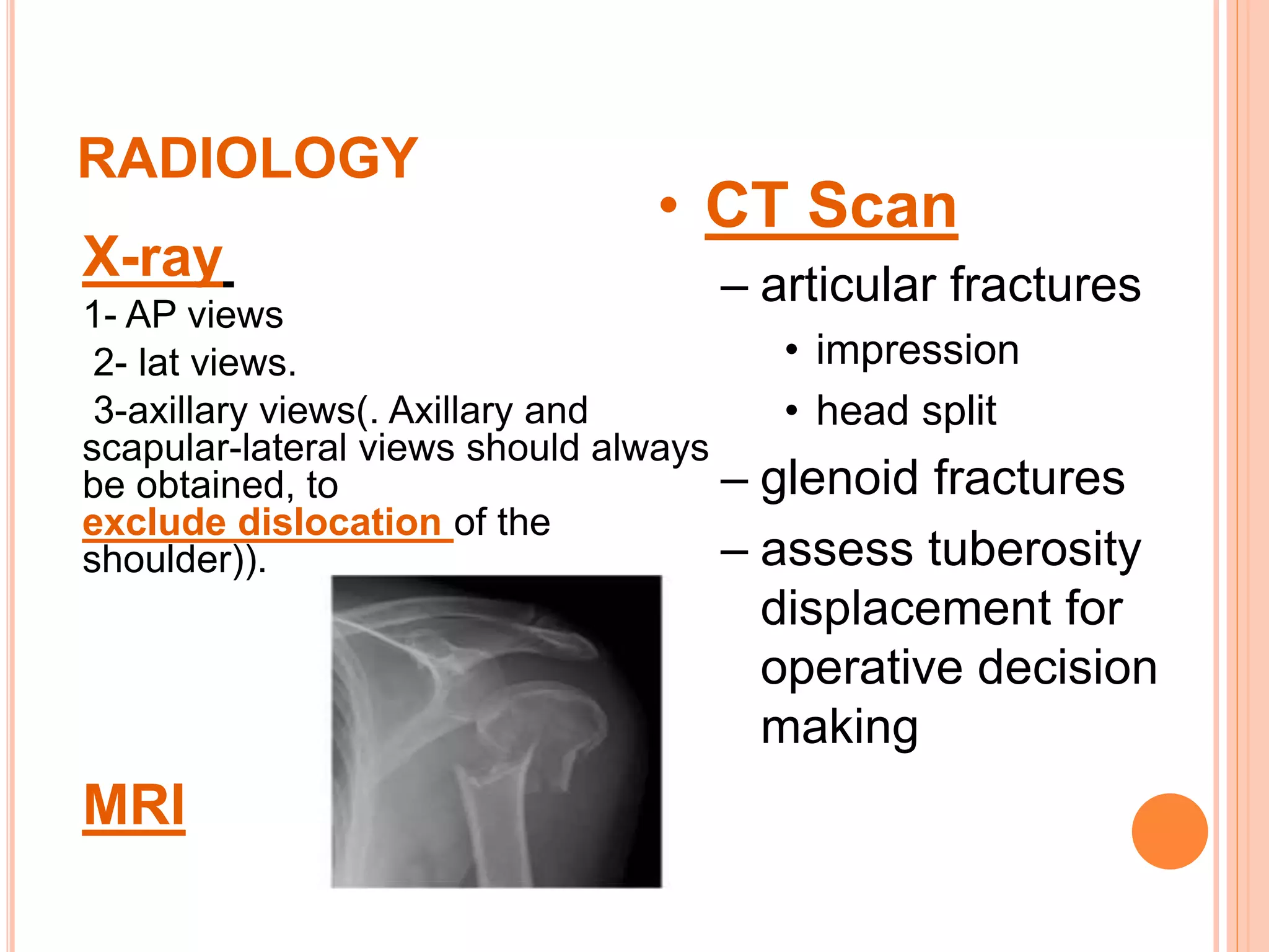 Proximal humerus fractures | PPTX