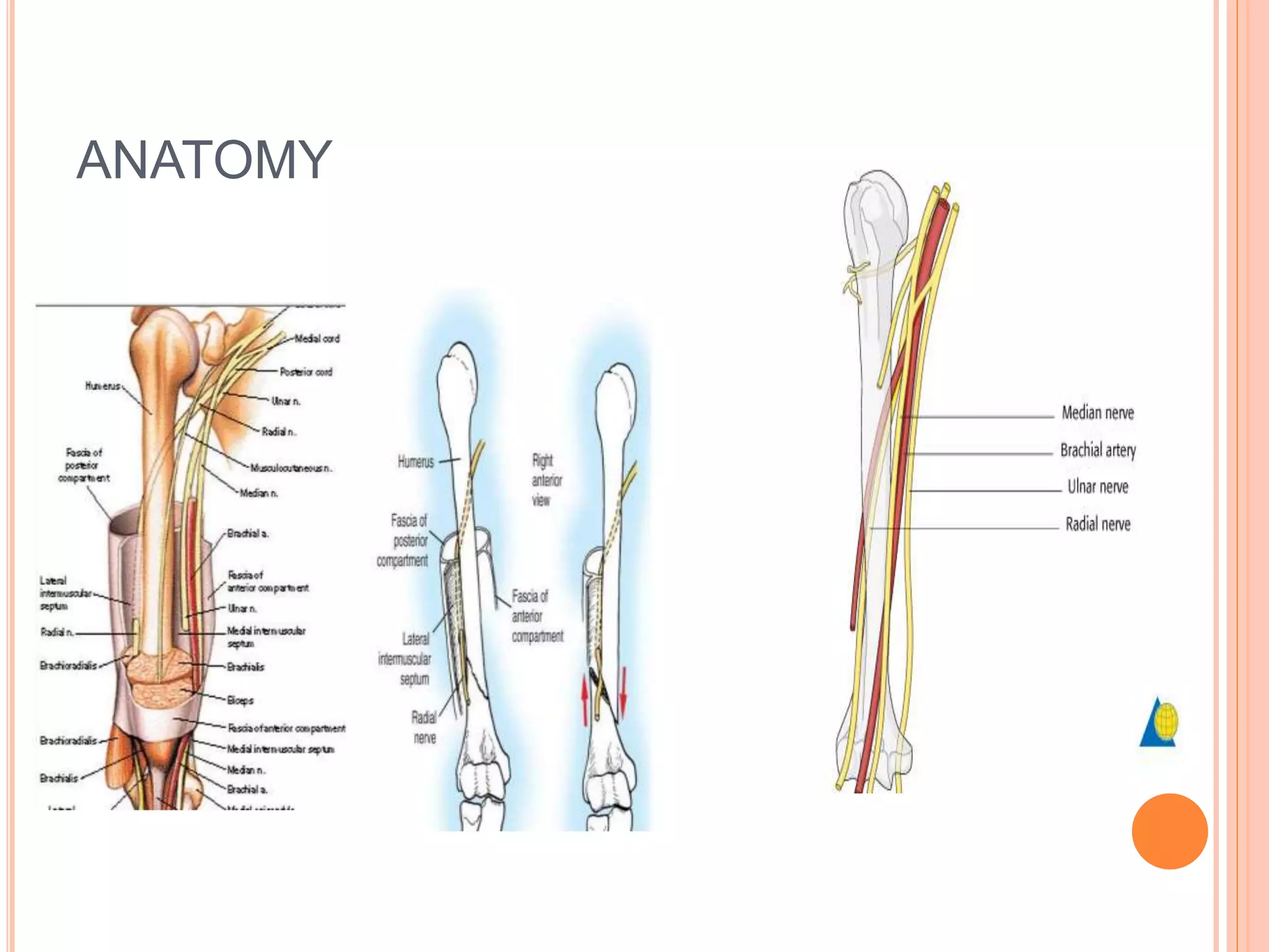 Proximal humerus fractures | PPTX