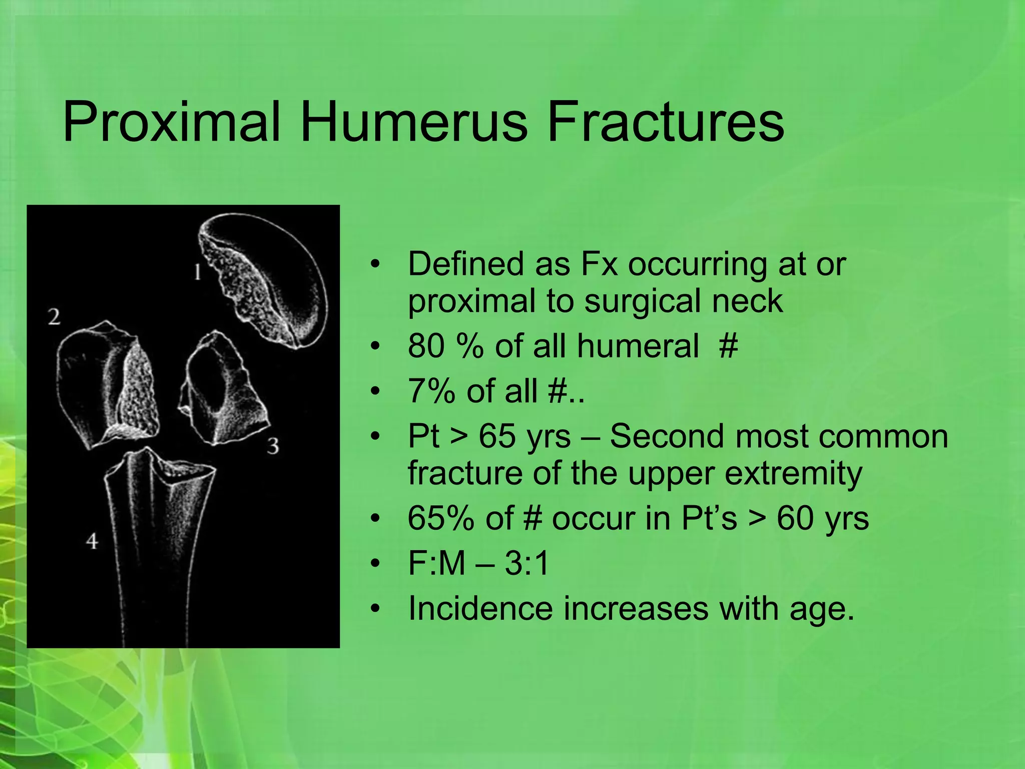 Proximal humerus fractures | PPTX