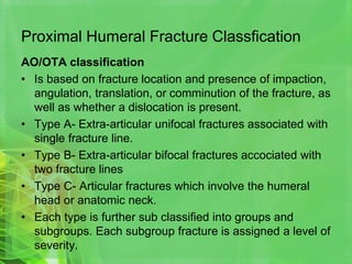 Proximal humerus fractures | PPTX