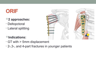Proximal Humerus Fractures basic knowledge | PPT