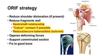 Upper limb trauma : Proximal Humerus Fractures | PDF