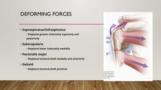 Proximal Humerus Fractures JAWAD in proiximal humerus | PPTX
