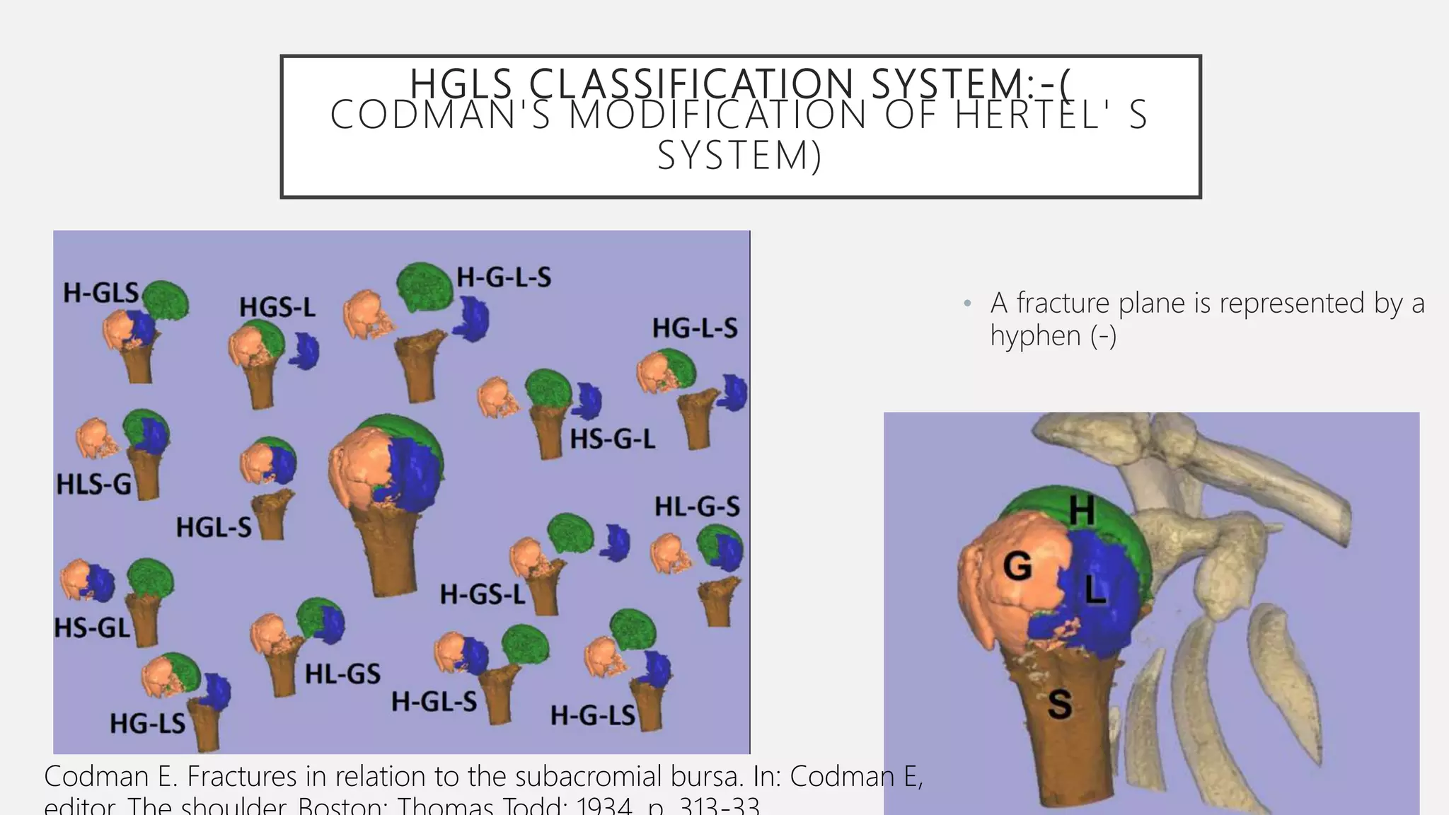 Proximal humerus fractures | PPTX