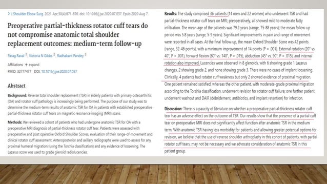 Proximal Humerus Non- Union.pptx
