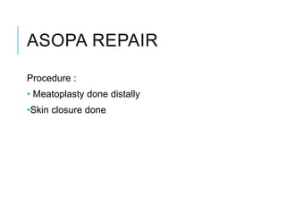 Surgical management of Proximal hypospadias.ppt