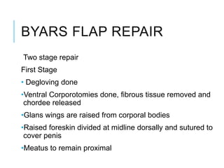 Surgical management of Proximal hypospadias.ppt