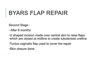 Surgical management of Proximal hypospadias.ppt