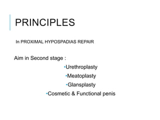 Surgical management of Proximal hypospadias.ppt