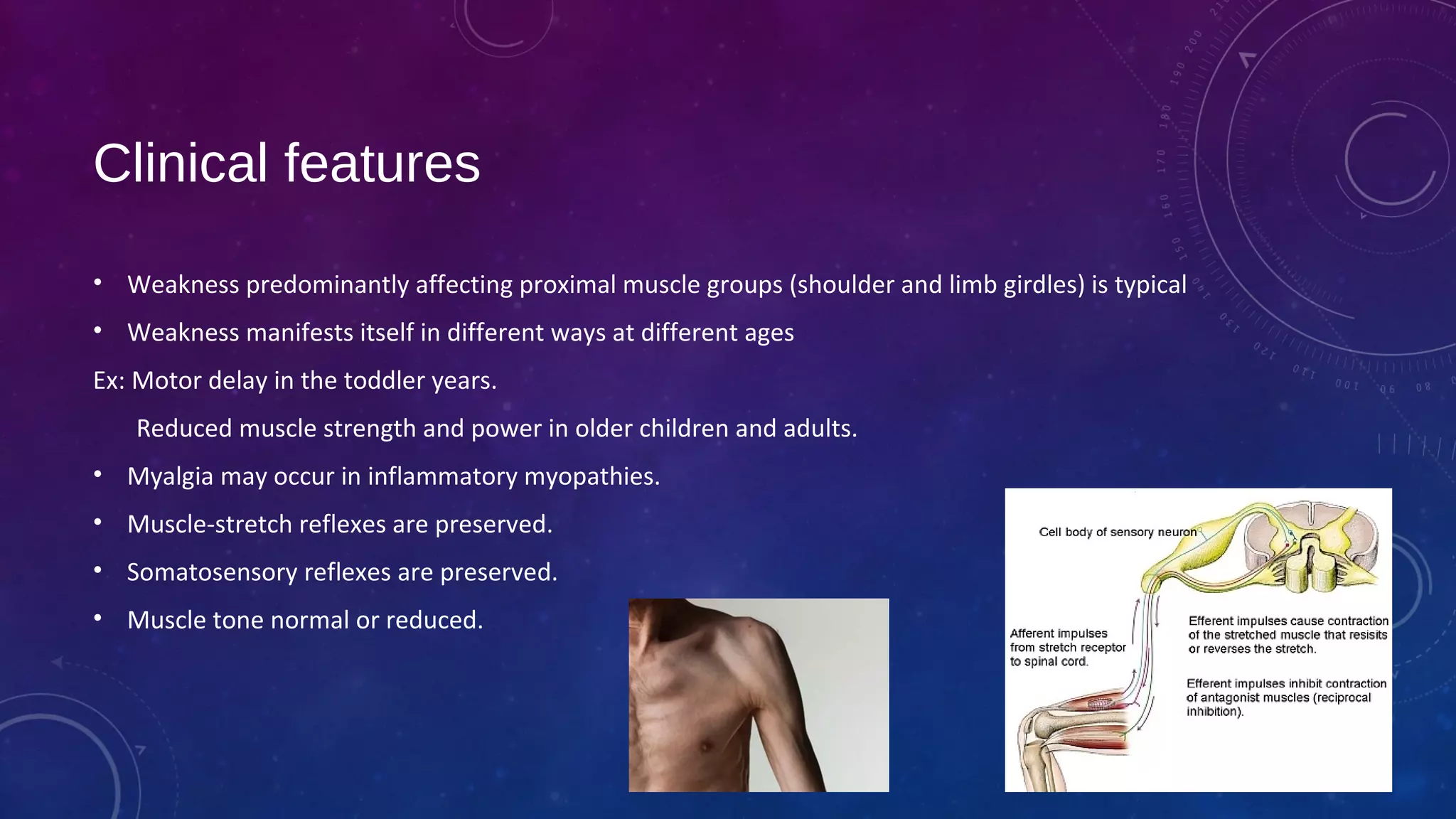 Proximal myopathy and causes | PPT