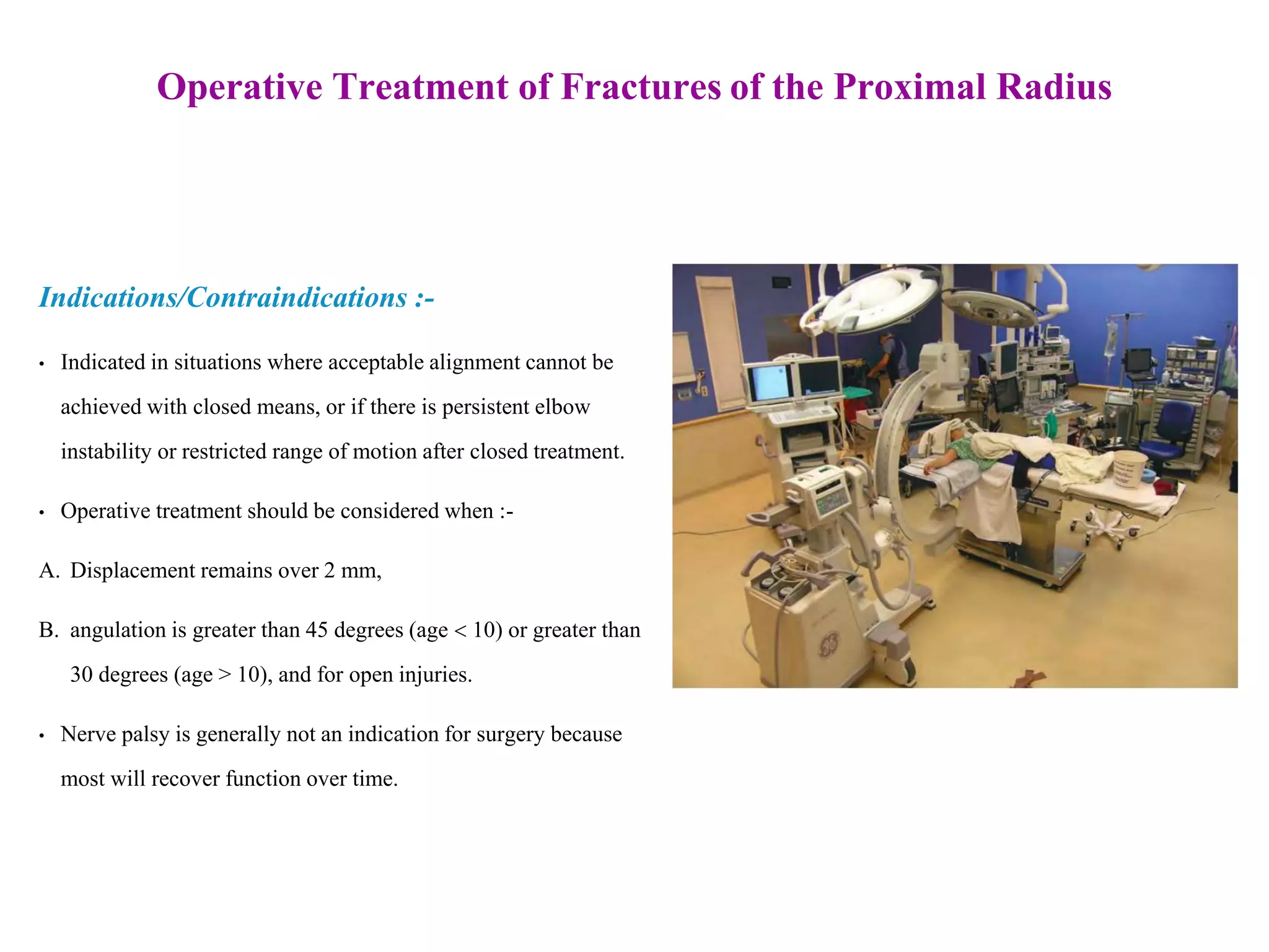 Proximal radius fractures in children | PPTX