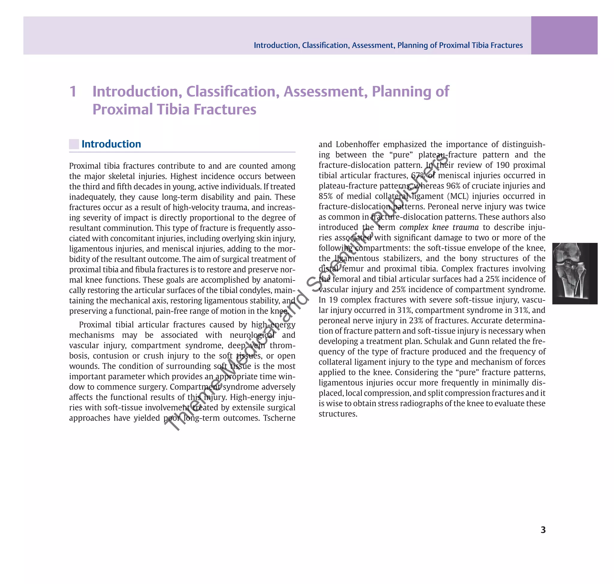 Guidelines in Fracture Management - Proximal Tibia by Babhulkar | PDF