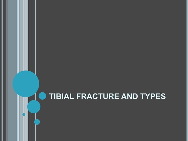 Proximal tibia fracture | PPTX