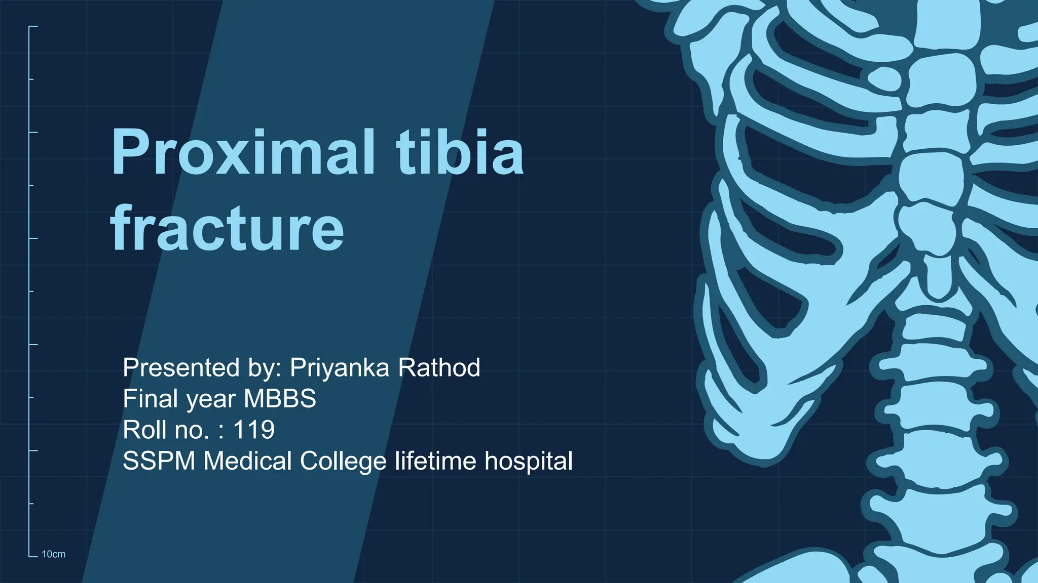proximal tibia fracture and mechanism with etiology | PPTX