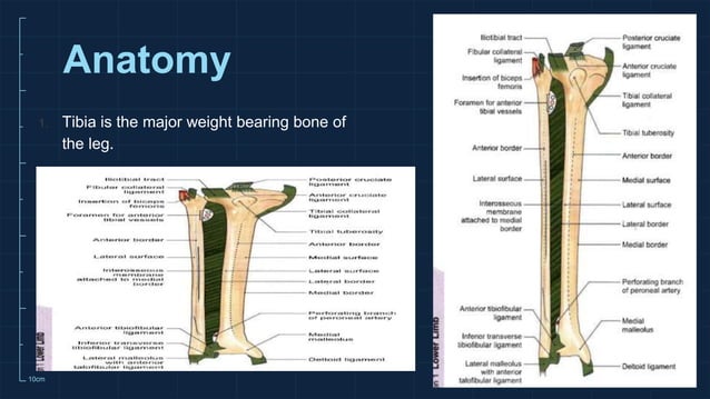 proximal tibia fracture and mechanism with etiology | PPTX