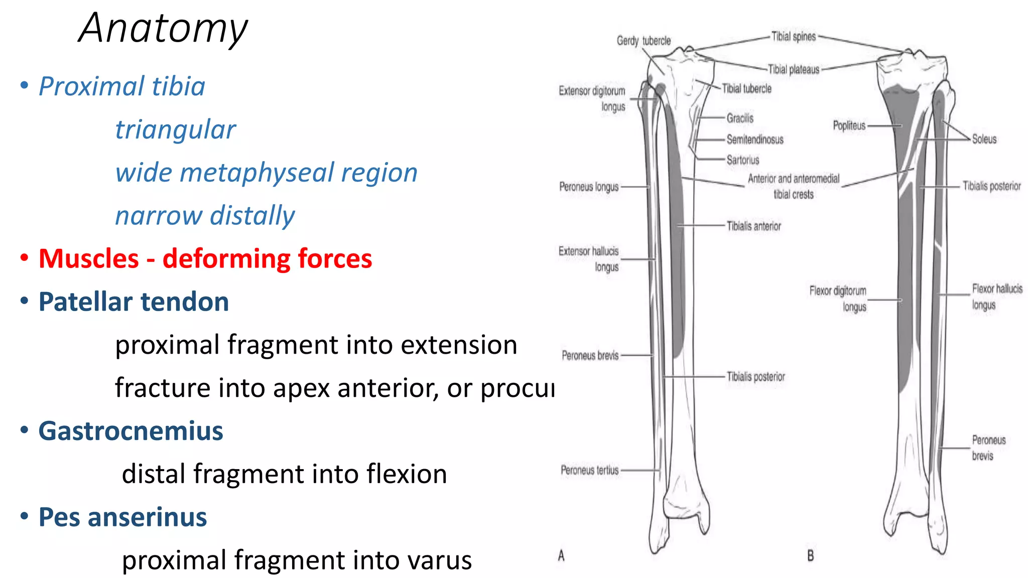 Proximal tibia fractures(Plateau, spine ,Tubercle and Epiphyseal ) | PPT | Death, Injury, or ...