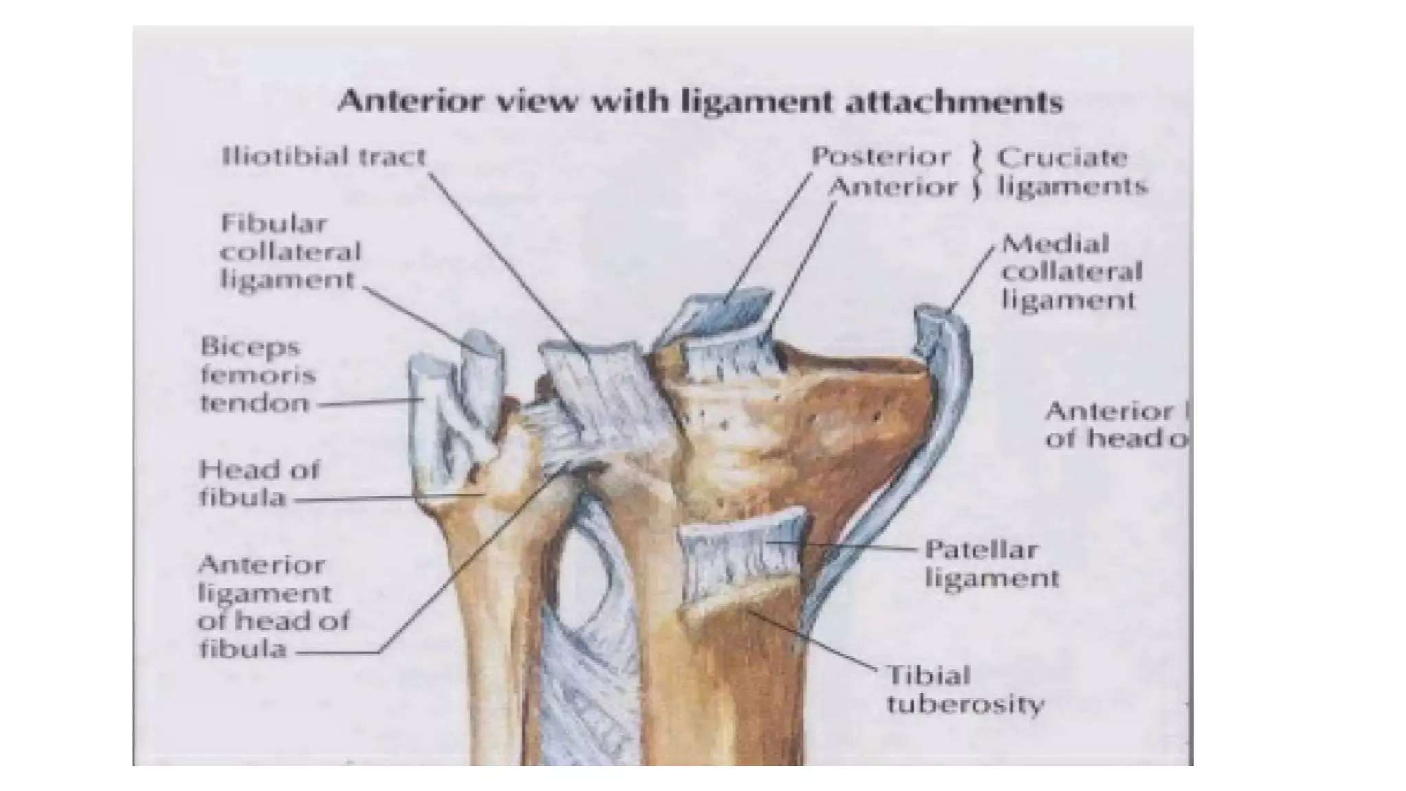 Proximal tibia fractures(Plateau, spine ,Tubercle and Epiphyseal ) | PPT