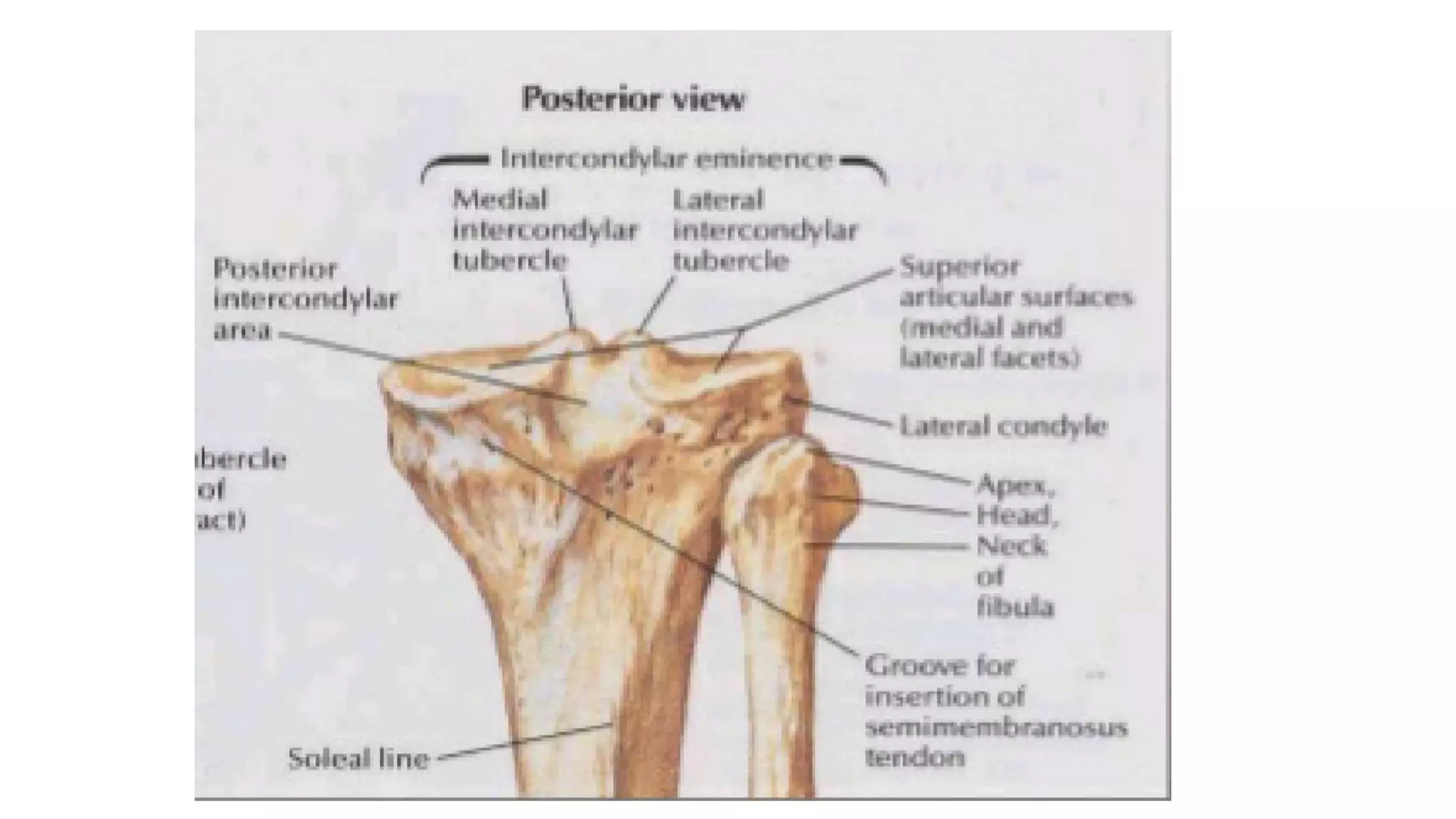 Proximal tibia fractures(Plateau, spine ,Tubercle and Epiphyseal ) | PPT