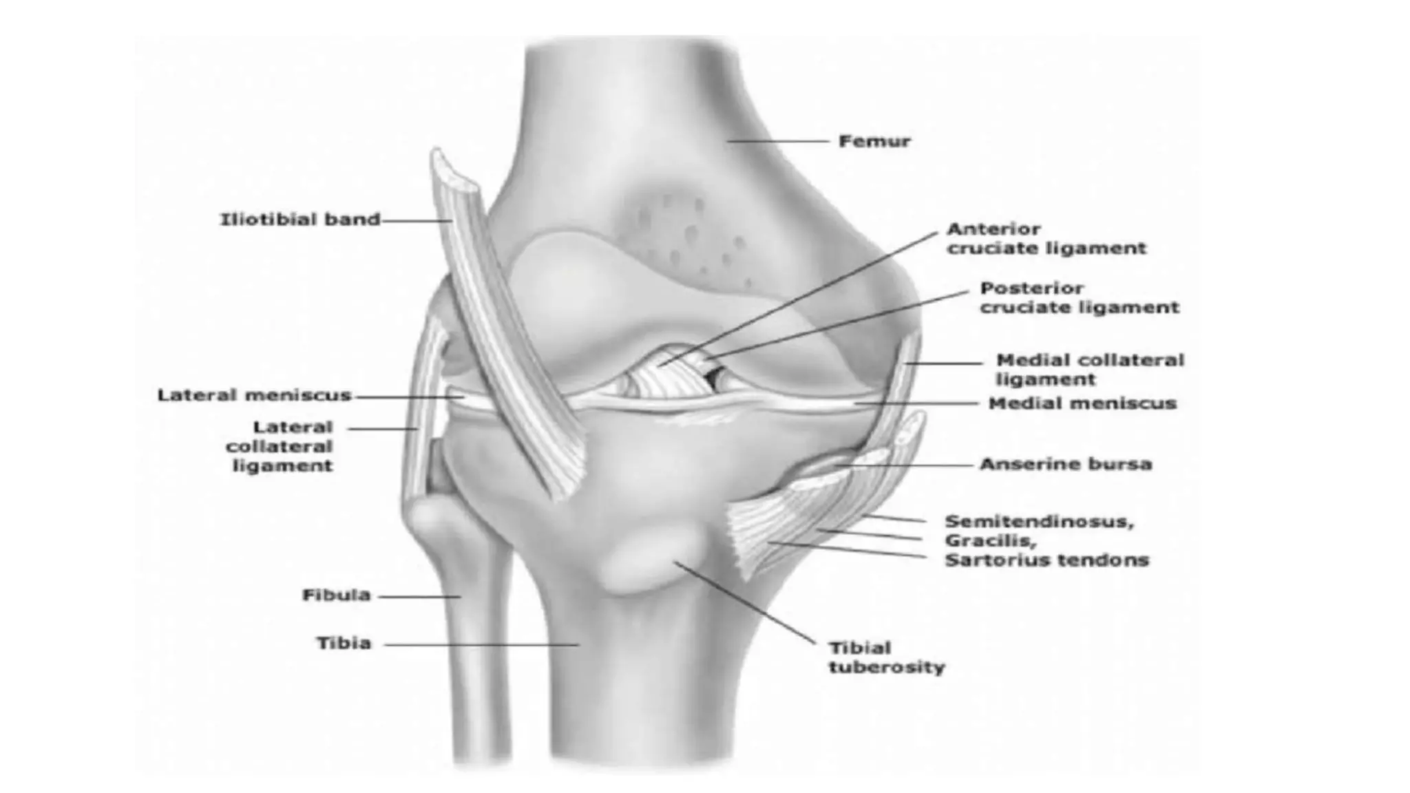 Proximal Tibia Fractures Plateau Spine Tubercle And Epiphyseal Ppt