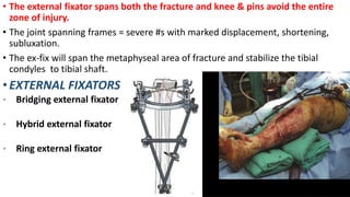 Proximal tibia fractures(Plateau, spine ,Tubercle and Epiphyseal ) | PPT