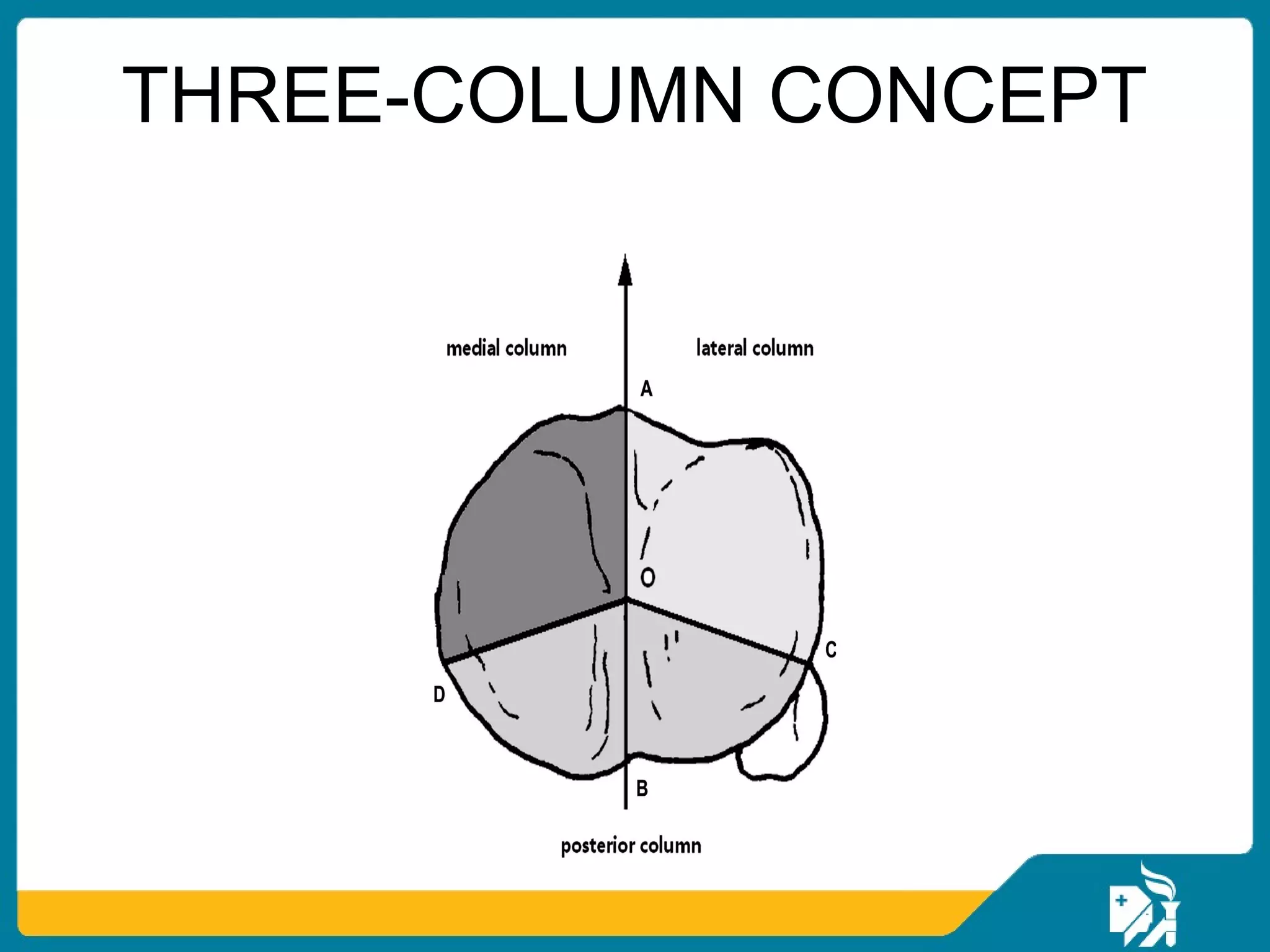 Proximal tibial fracture | PPT