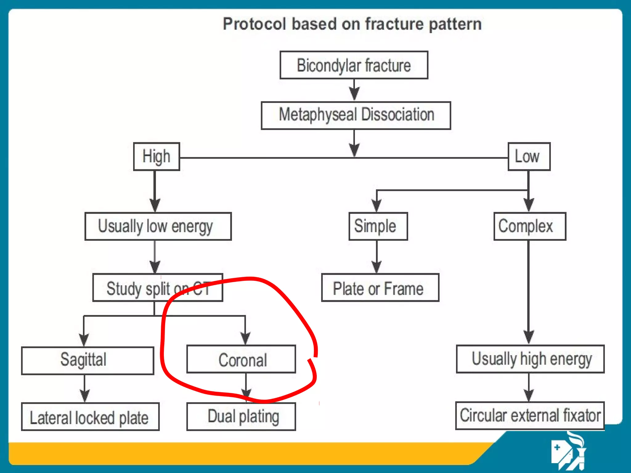 Proximal tibial fracture | PPT