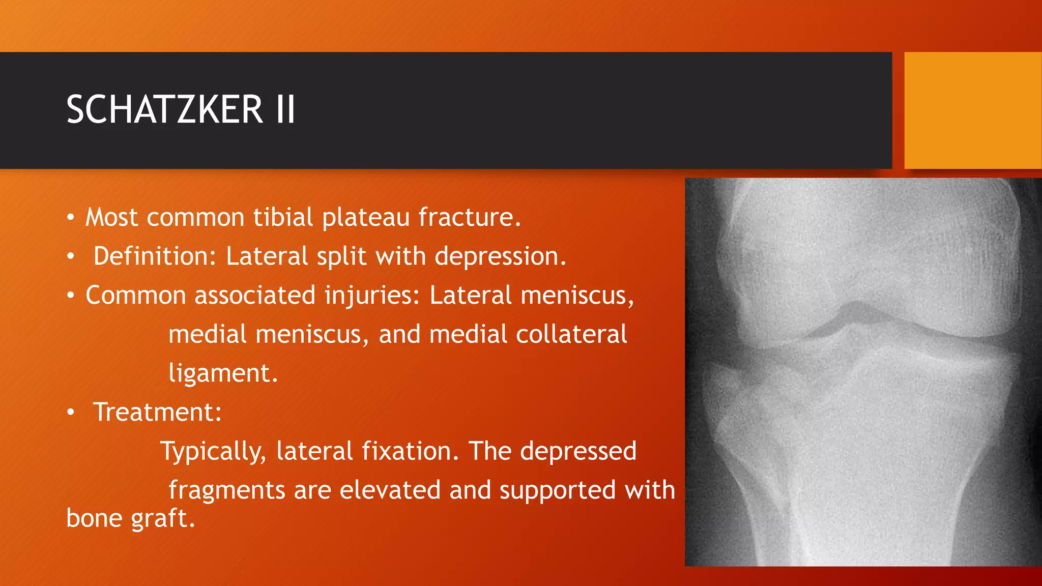 PROXIMAL TIBIAL FRACTURE.pptx