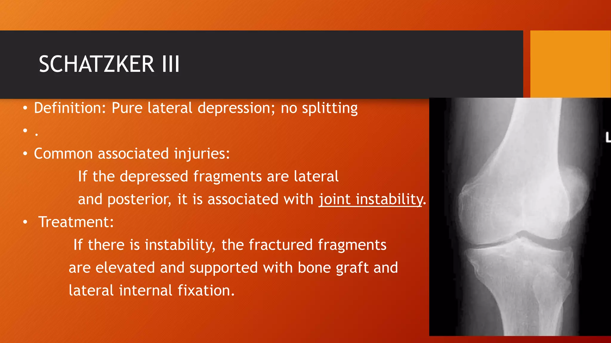 PROXIMAL TIBIAL FRACTURE.pptx