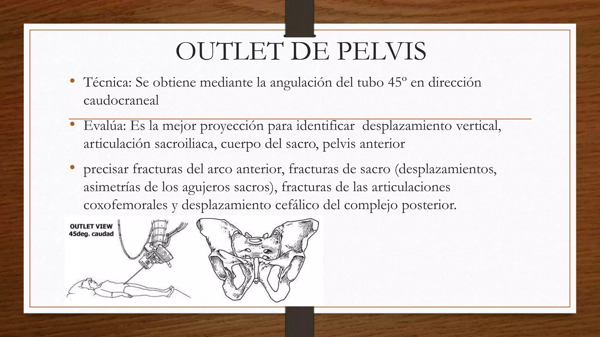 Proyección de pelvis inlet outlet | PPTX