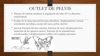 Proyección de pelvis inlet outlet | PPTX