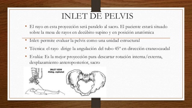 Proyección de pelvis inlet outlet