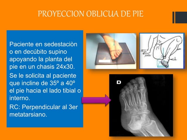 Proyeccion ap, lateral y oblicua del pie | PPTX