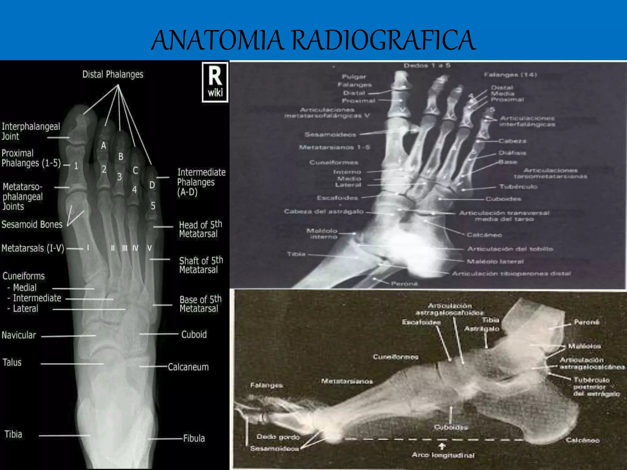 Proyeccion ap, lateral y oblicua del pie | PPTX