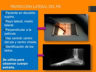 Proyeccion ap, lateral y oblicua del pie | PPTX