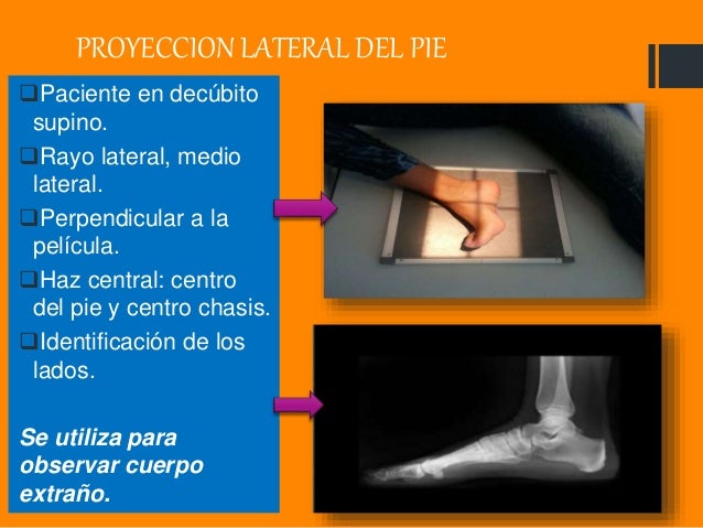 Proyeccion ap, lateral y oblicua del pie