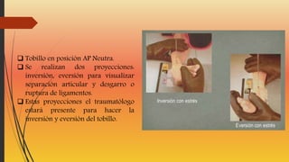 Proyecciones del tobillo. | PPTX