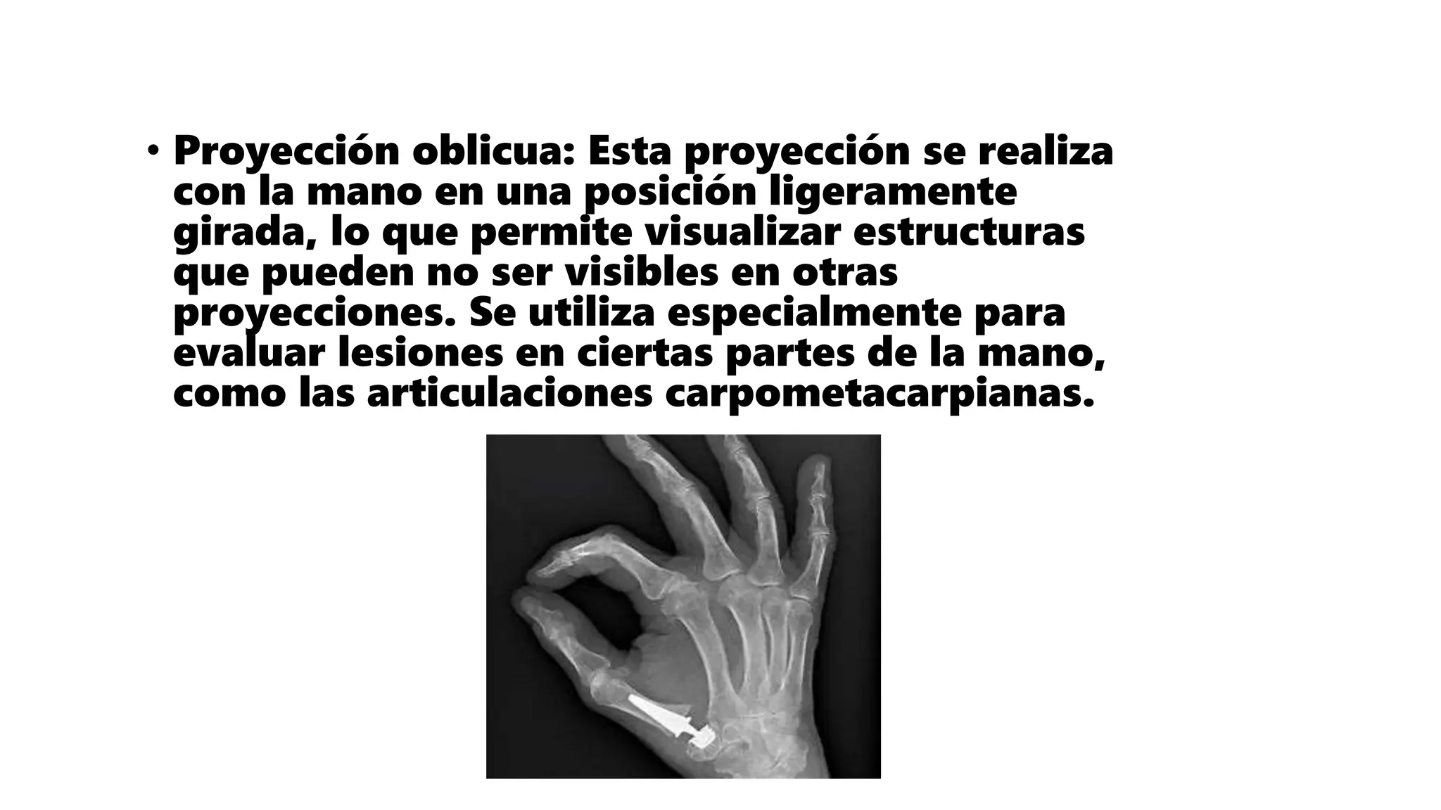 proyeccion radiografíacas de mano FER_060824.pptx