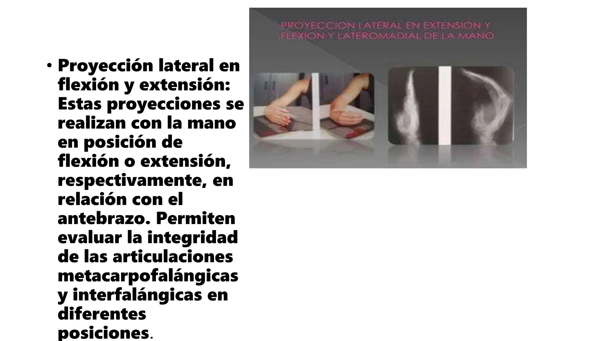 proyeccion radiografíacas de mano FER_060824.pptx