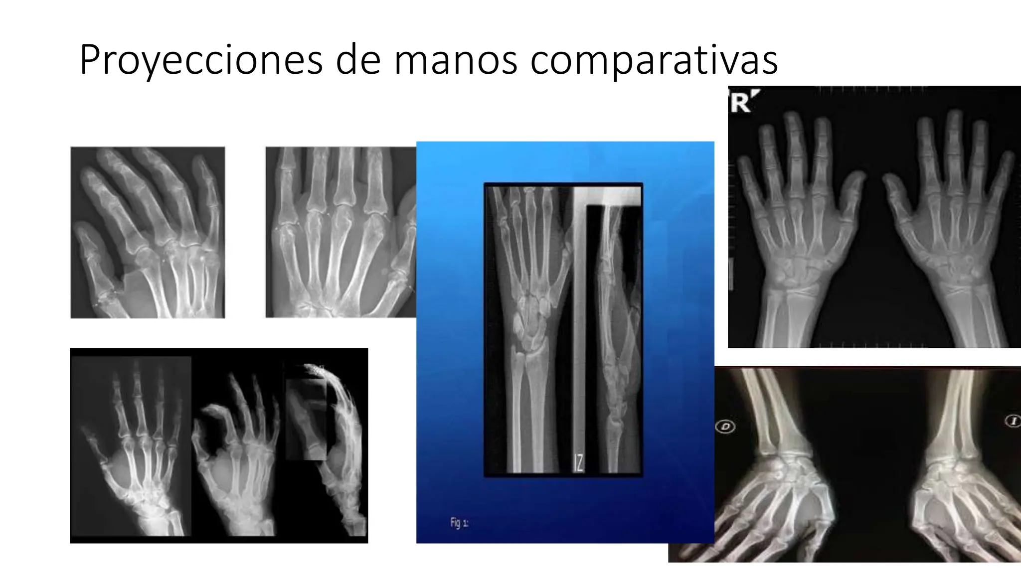 proyeccion radiografíacas de mano FER_060824.pptx