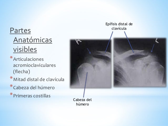 Proyecciones clavícula y especiales detórax