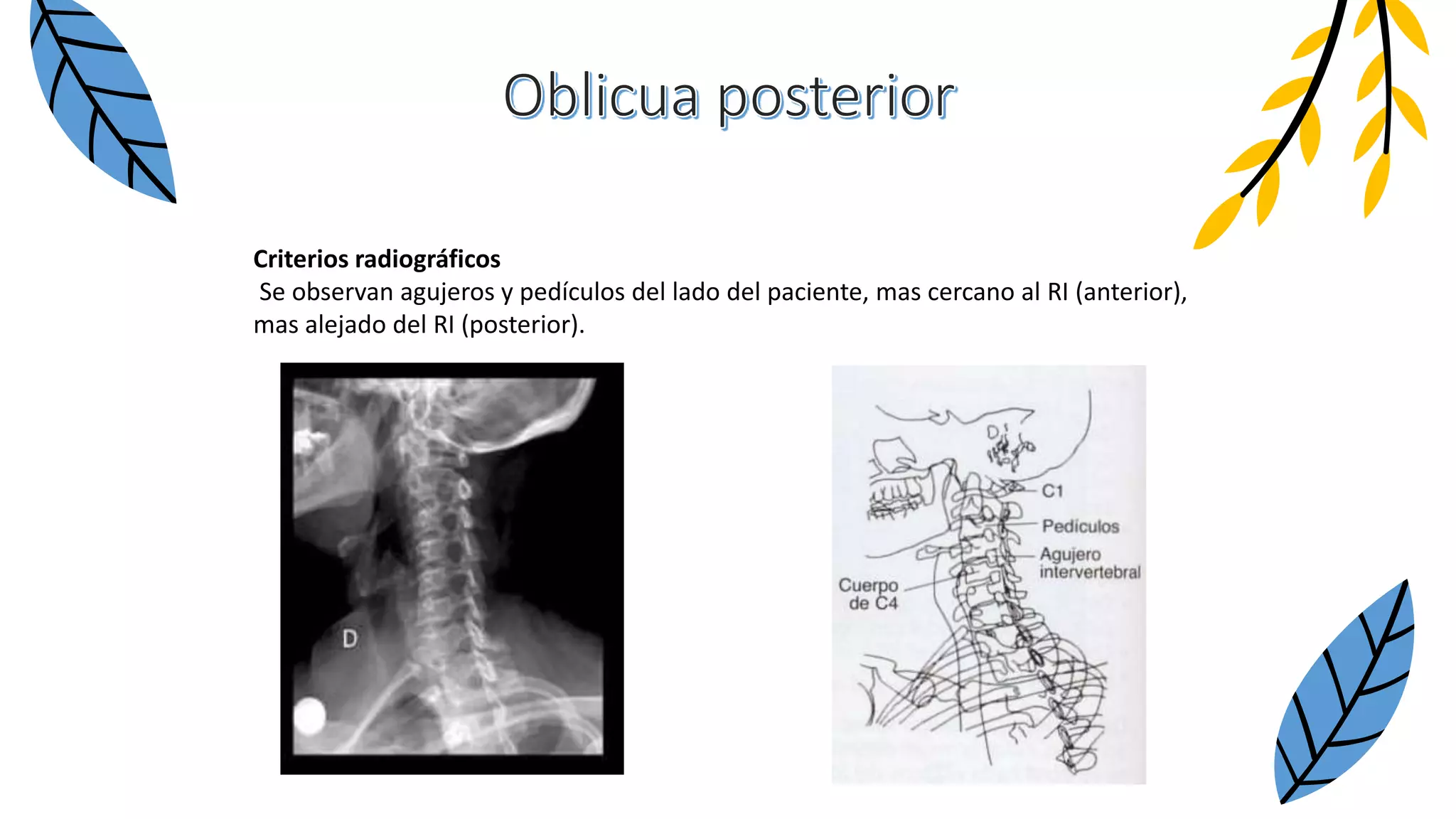 Proyecciones de columna cervical.pptx