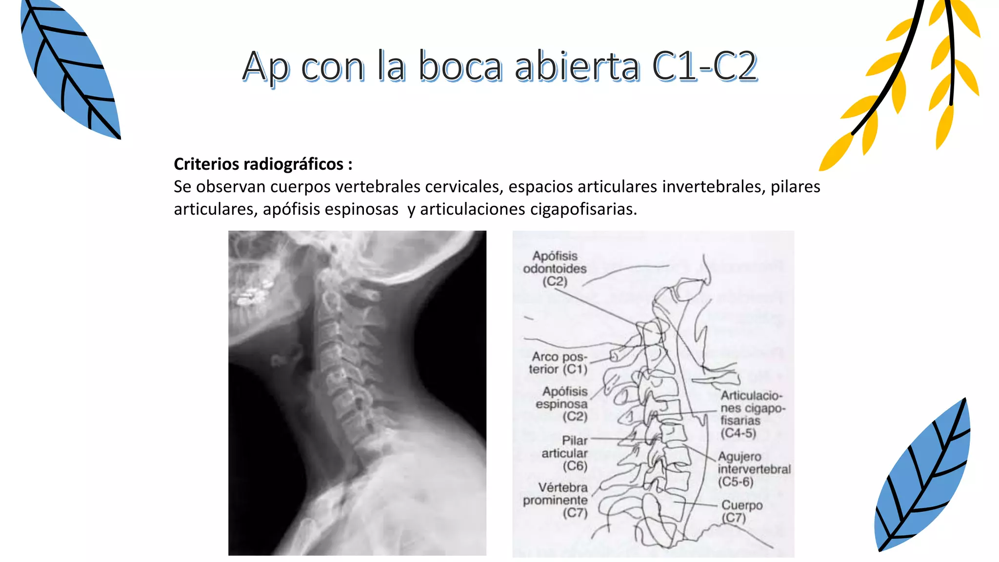 Proyecciones de columna cervical.pptx