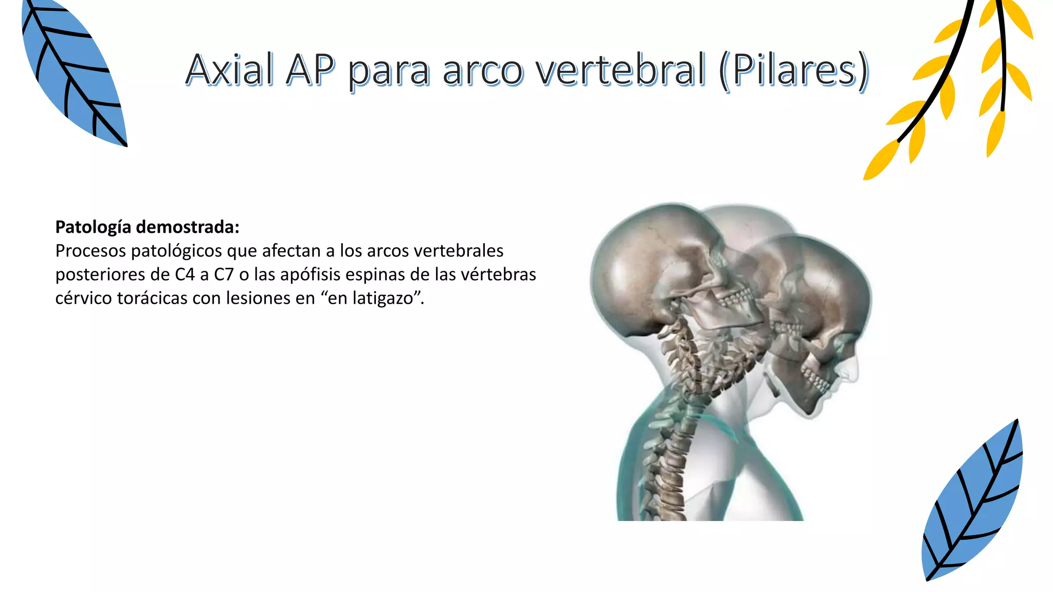Proyecciones de columna cervical.pptx