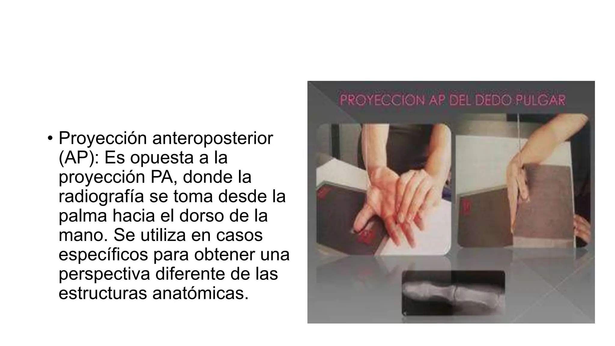 Proyecciónes de dedos así como sus fslsnges fer.pptx