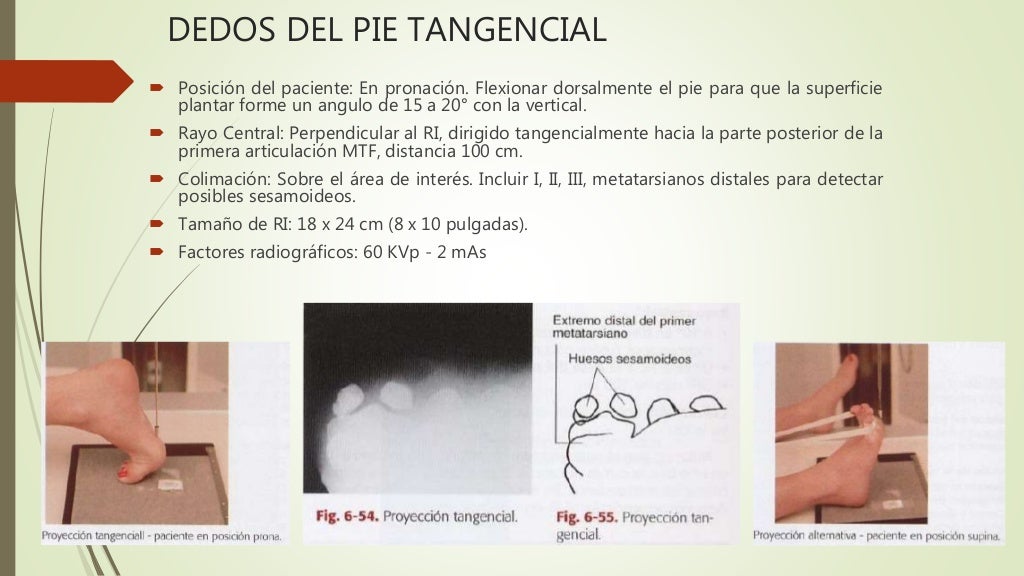 Proyecciones de tobillo y ortejos