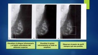 proyecciones en mastografia (3).pptx