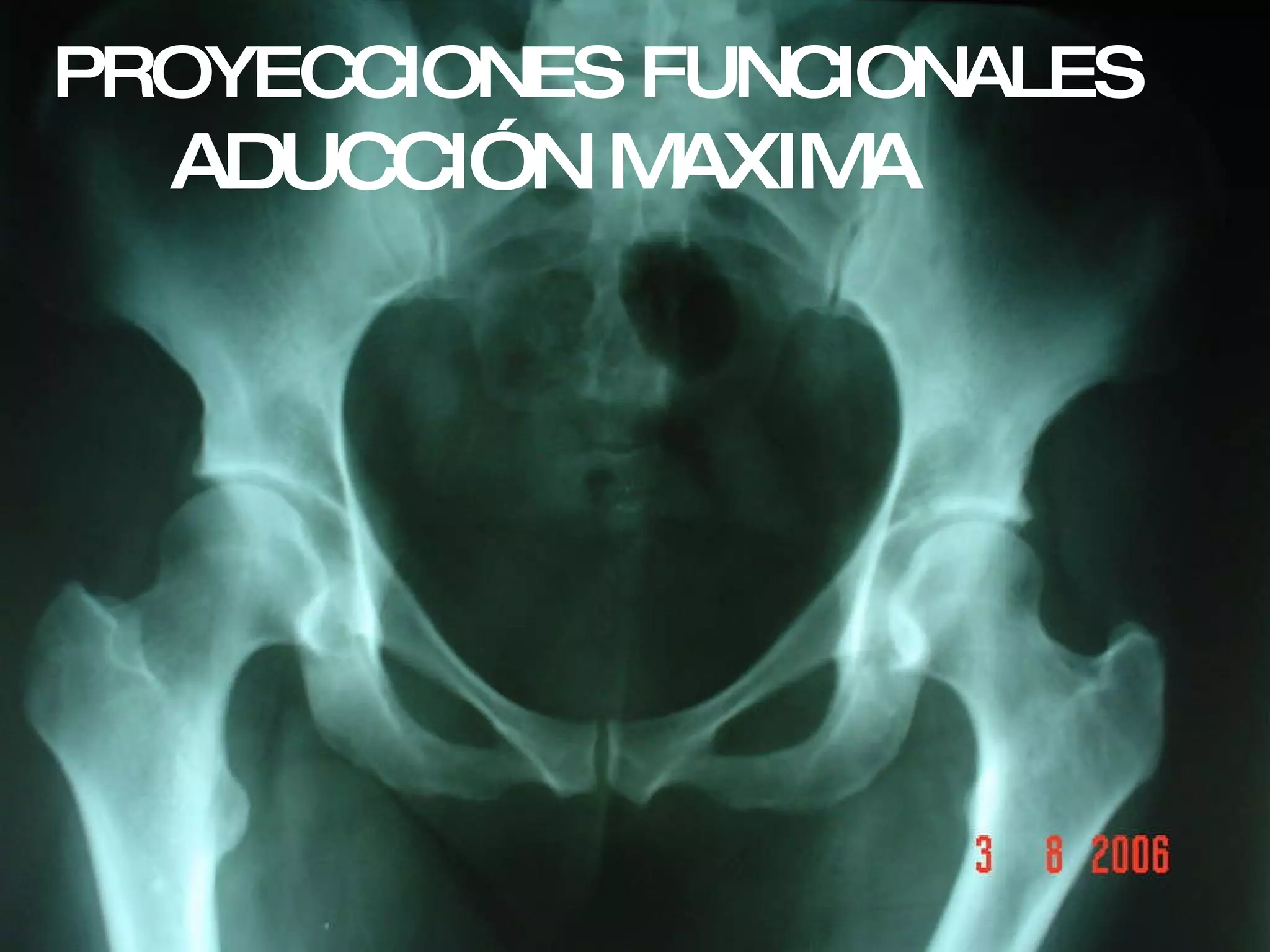 rx Pelvis.proyec.no convencionales-Lic.Juan Jose MOntico -Argentina ...