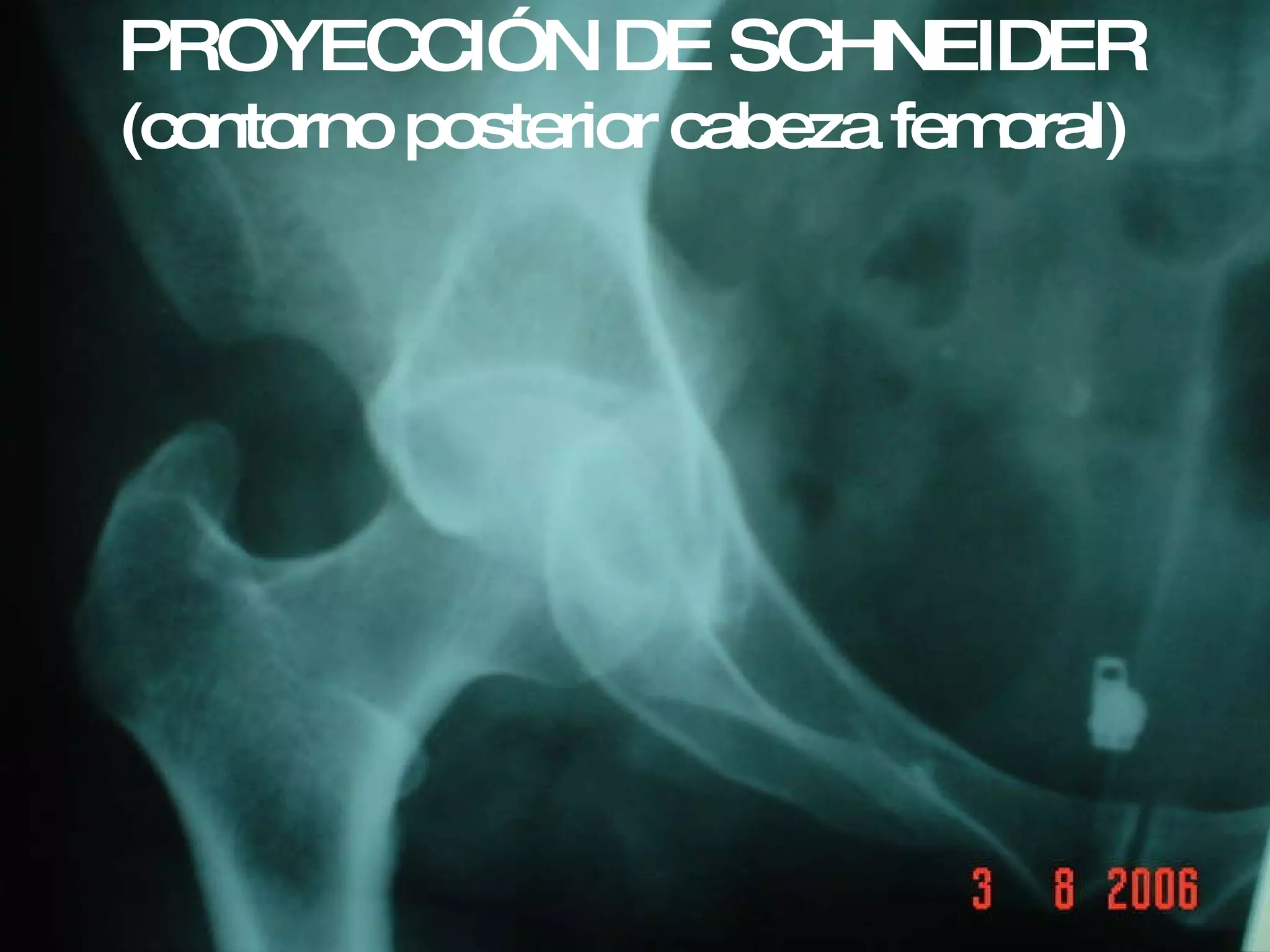 rx Pelvis.proyec.no convencionales-Lic.Juan Jose MOntico -Argentina ...